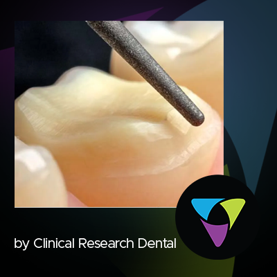 Choosing the Right Burs for Optimal Restorative Results and Productivi ...