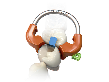 Ultradent Halo Universal Matrix Rings – Clinical Research Dental